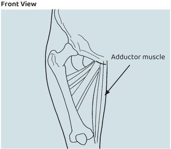 Single-Event Multilevel Surgery (SEMLS) Procedures