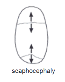 Craniosynostosis Surgery: Frequently Asked Questions