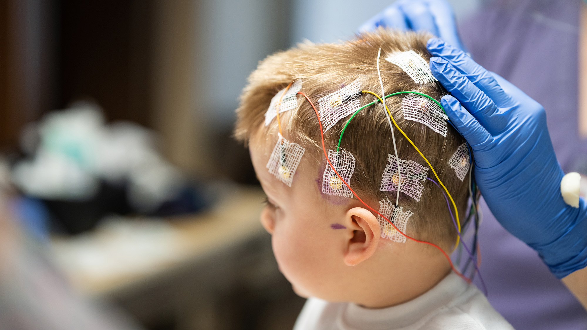 Neurosurgery Team Offers Expertise, From Simple to Complex