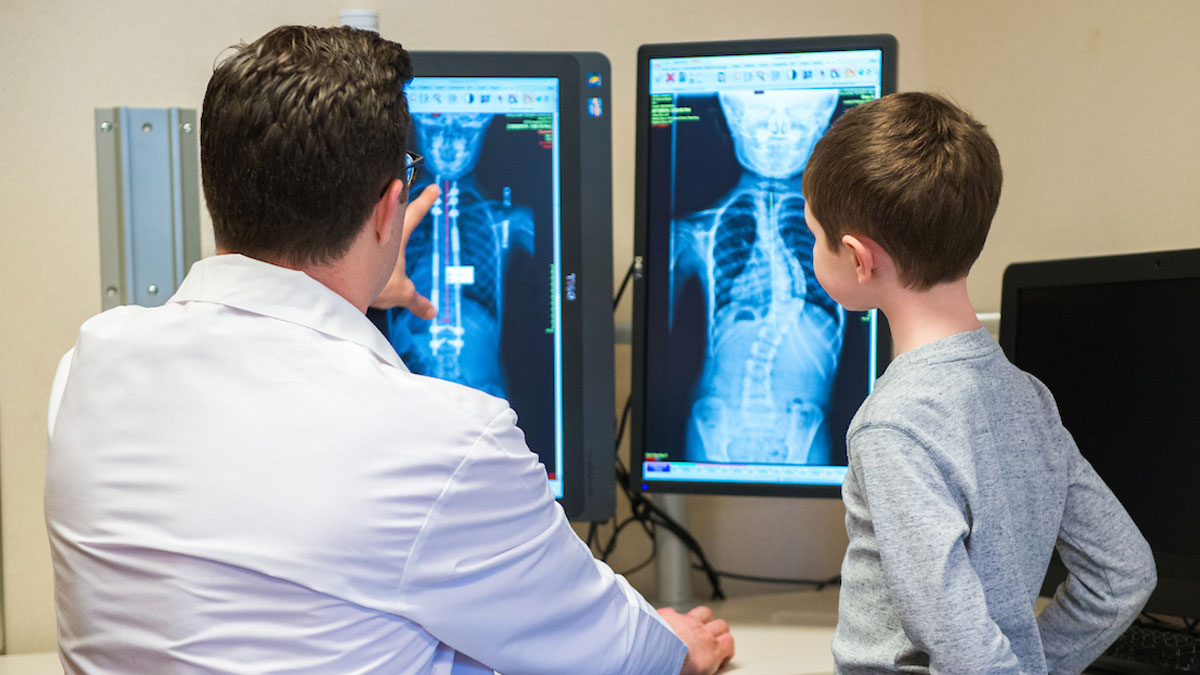 Tools to Assess Skeletal Maturity | Gillette Children's